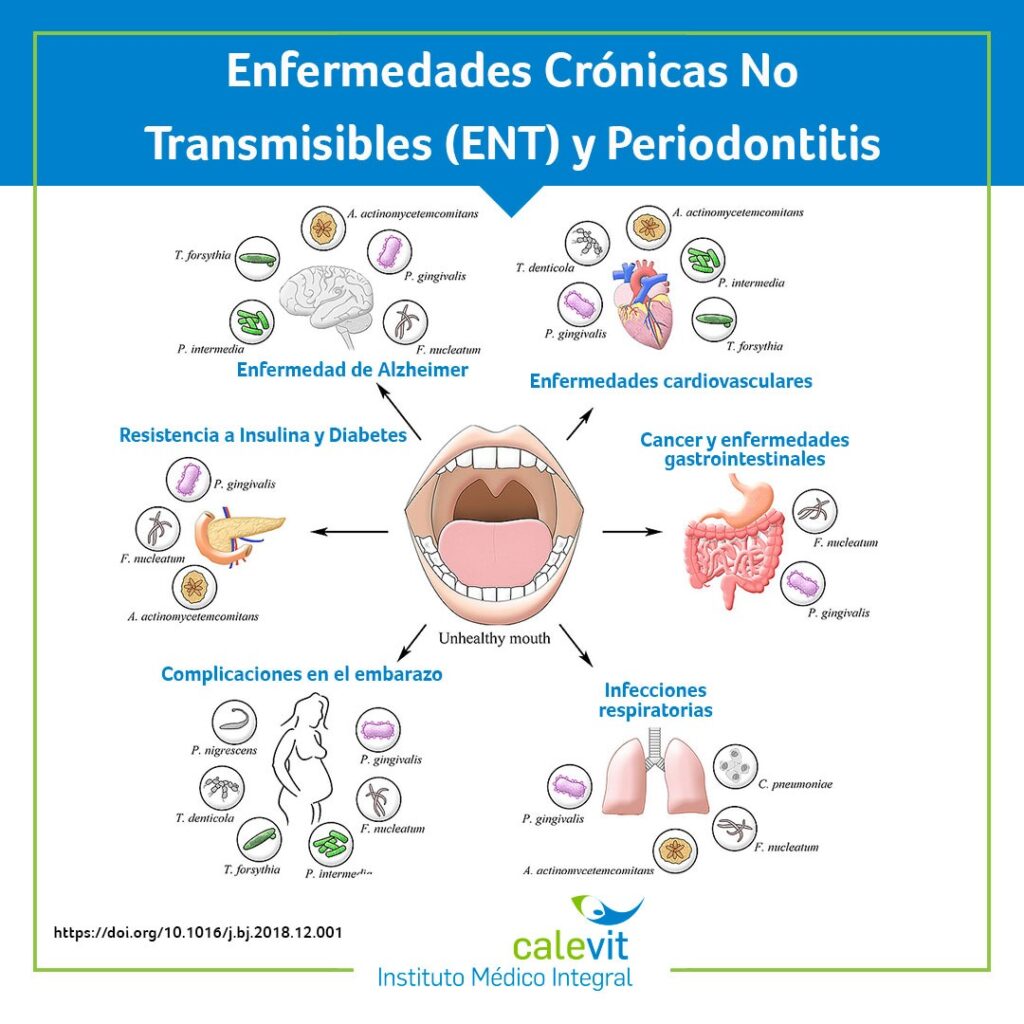 Enfermedades Crónicas No Transmisibles (ENT) y Periodontitis - Calevit